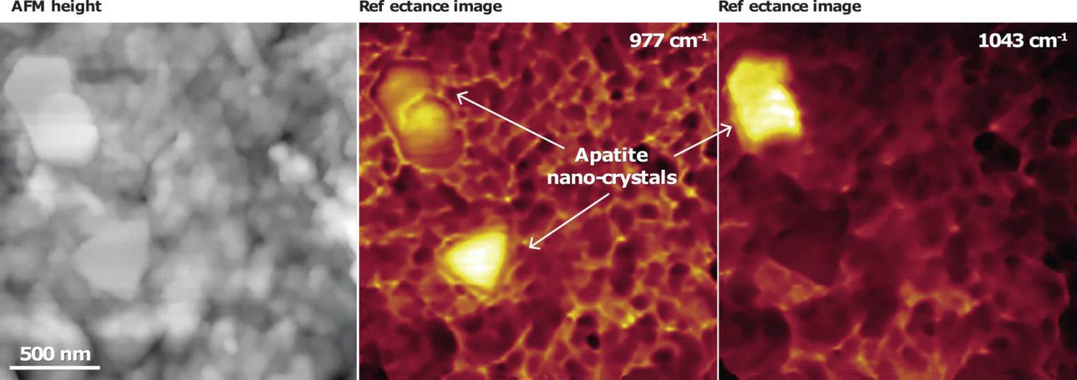 Structure and chemical composition of human bones in nanoscale - NicoletCZ
